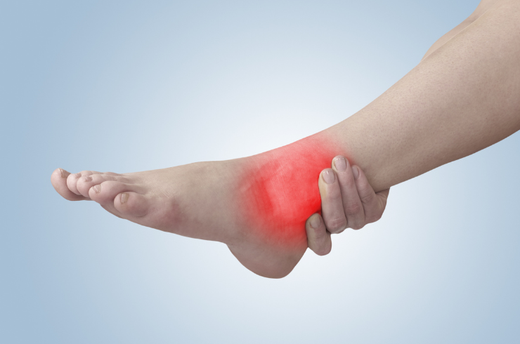 Acute Limb Ischemia - Pulse Hospital